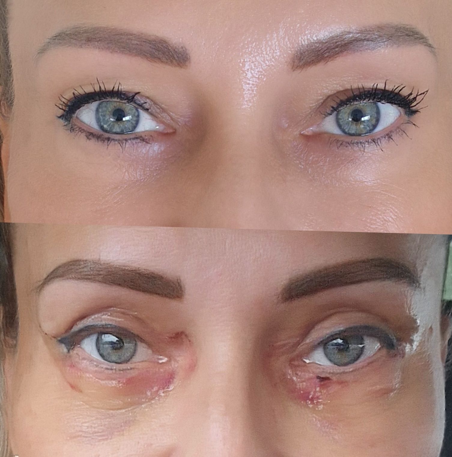 Operace horních a dolních víček > MUDr. Jiří Ferra - Operace očních ...